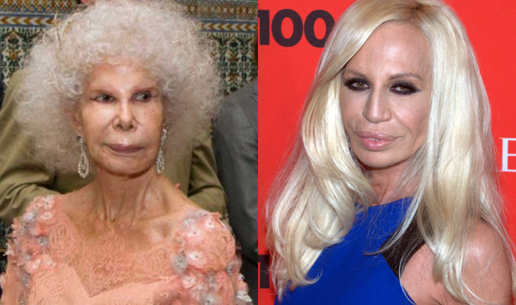 La personas inexpresivas de “la era del bótox” pierden la capacidad de ...